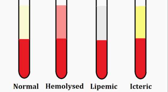 OWLEDGE DRILL 9-7: SERUM APPEARANCE Color the serum in the numbered ...