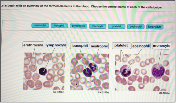 Let's begin with an overview of the formed elements in the blood ...