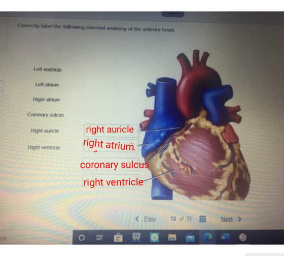 Correctly label the following external anatomy of the anterior heart 16 ...