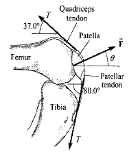 he figure shows the quadriceps and the patellar tendons attached to the ...